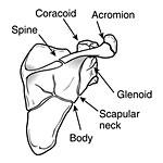 Scapula (Shoulder Blade) Fractures - OrthoInfo - AAOS