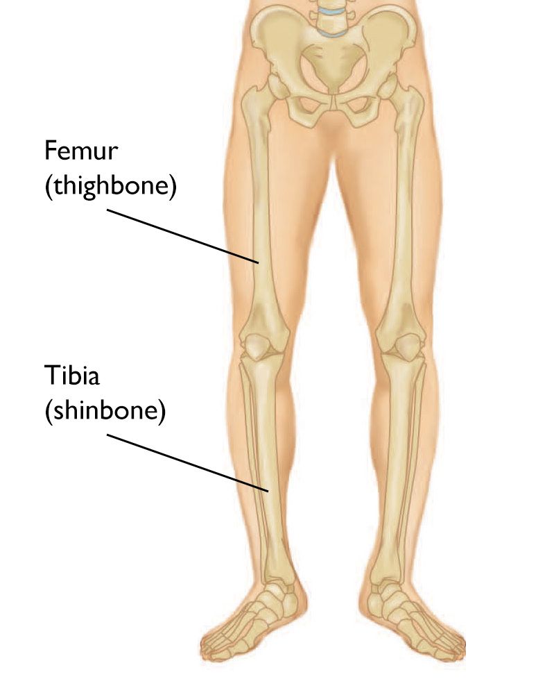 Malunion In The Lower Limb OrthoInfo AAOS