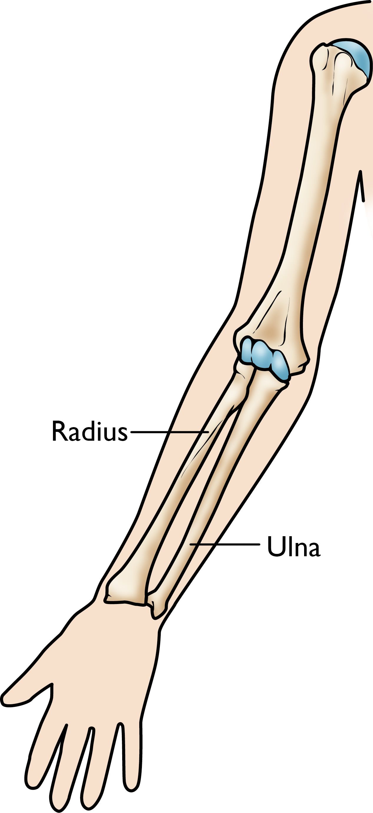 Forearm Fractures In Children Types And Treatments OrthoInfo AAOS